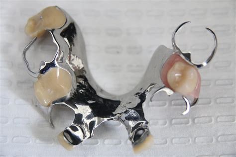 Denture Clinic Gold Coast Gallery Denture Doctor