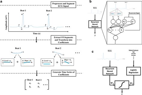 A St Segment Feature Extraction Process The Ecg Signal Is First