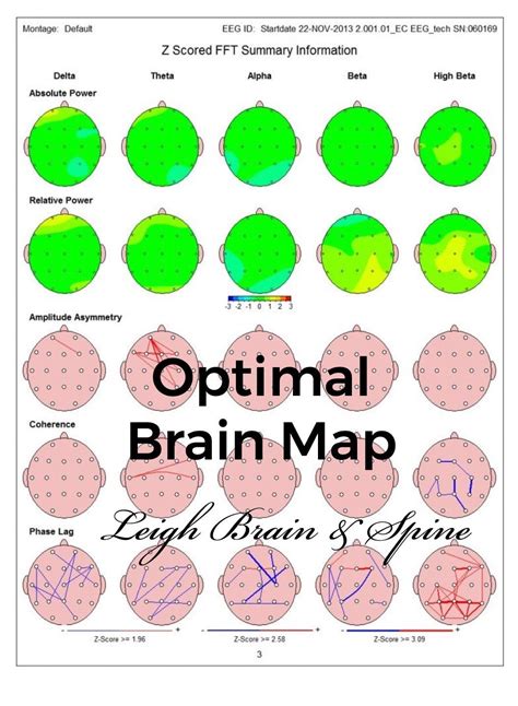 What Is Brain Mapping And How Does It Work