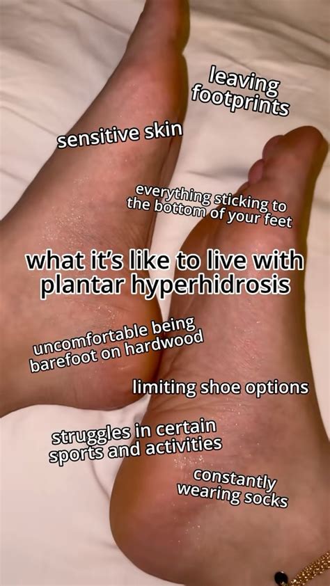 The Center For Hyperhidrosis Understanding The Impact Of Excessive Sweating—and Our Work At