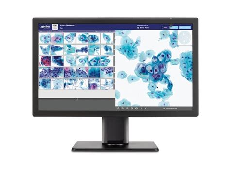 Hologics Digital Cytology System Gets Fda Clearance Clinical Lab Products