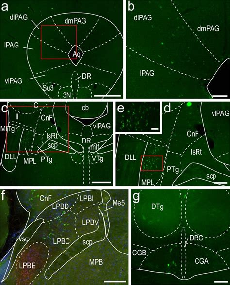 Retrograde Labeling In The Brainstem After Ctb Injection In The Left
