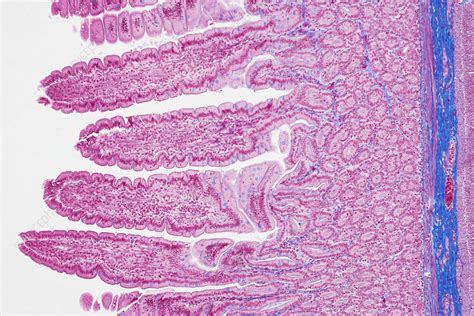 Small Intestine Slide