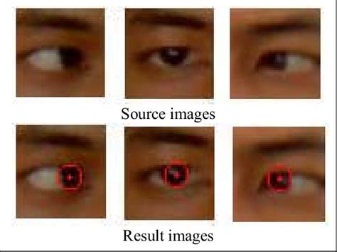 Examples Of Iris Detection Download Scientific Diagram