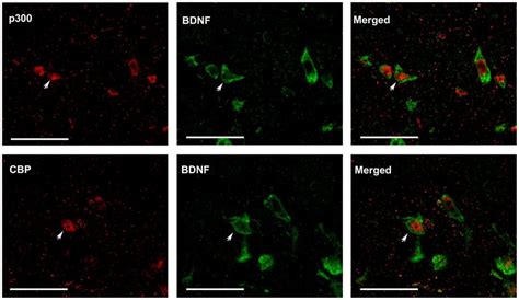 Double Immunofluorescence Staining Of P300creb Binding Protein Cbp