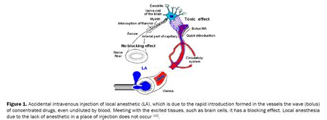 Systemic Reactions Of Intraosseous Vascular Spongy Anesthesia Open Access Journals
