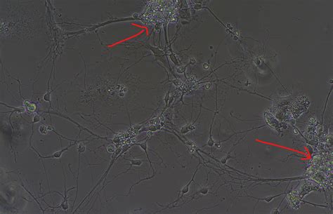 Can Anybody Suggest A Best Protocol For Culturing Primary Cortical Neurons From Post Natal Rat