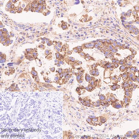 Anti Mavs Antibody Rm2067 Ab322353 Abcam