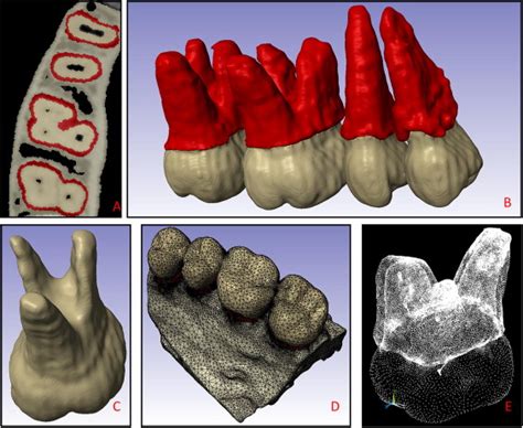 Axes Of Resistance For Tooth Movement Does The Center Of Resistance