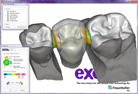 Exocad Design Dental CAD Website