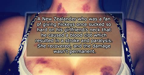 10 Sex Related Injuries That Will Make You Cringe EBaum S World