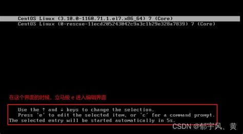 Linux（版本：高于centos76）找回root密码 超级详细！！！oracle Linux 重置root密码 Csdn博客