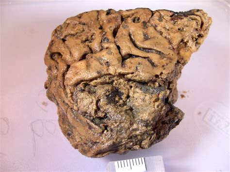 Incredible Heslington Brain Resists Rotting For 2600 Years Heres