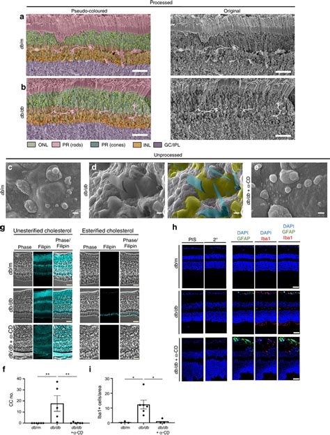 α Cd Dissolves Ccs And Reduces Iba1 Content In Vivo Representative Download Scientific Diagram