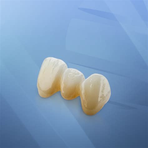 Lithium Disilicate Elegant Lab