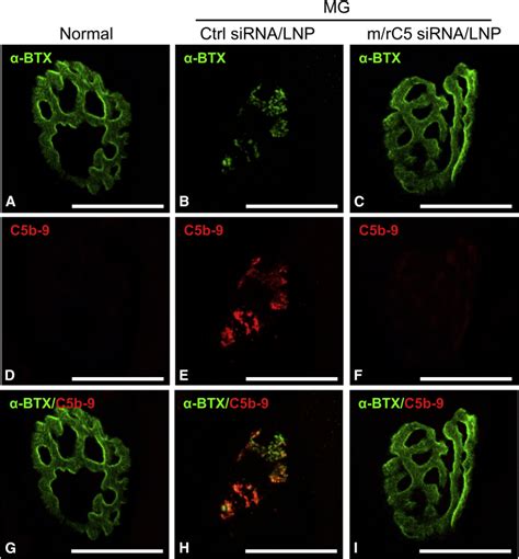 Identification Of Potent Sirna Targeting Complement C5 And Its Robust Activity In Pre Clinical