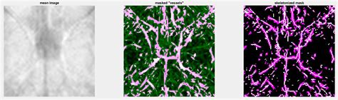 Matlab Shortest Path Along Skeletonized 3d Mask Stack Overflow