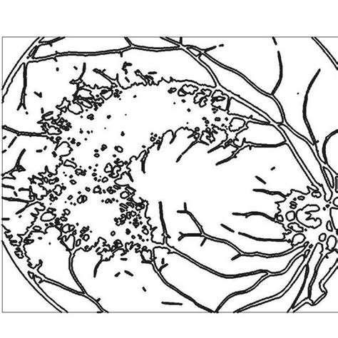 result of edge detection from the wavelet transform of figure 7