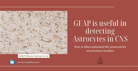 Wax It Histology Services Offers Ihc Methods For Neuropathology Wax It Histology Services Inc