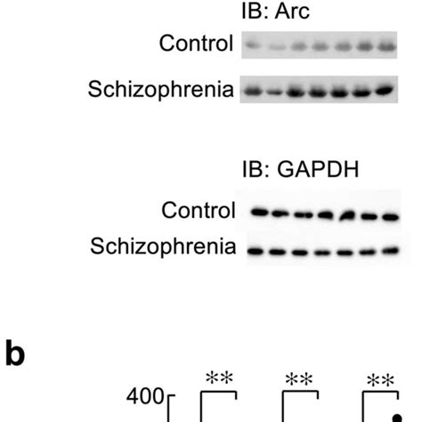 Protein Levels Of Egr1 C Fos And Arc In The Postmortem Auditory Download Scientific Diagram