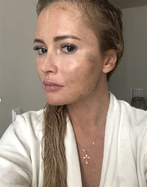 Могли бы натянуть и посильнее Дана Борисова показала лицо после пластики