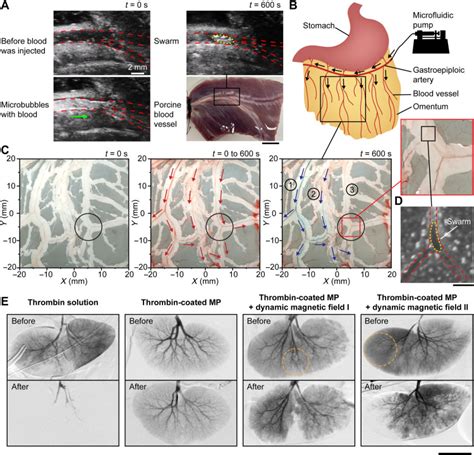 Microrobotic Swarms For Selective Embolization Pmc