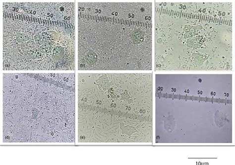 Figure 1 From Detection Of Acanthamoeba Spp In Two Major Water Reservoirs In The Philippines