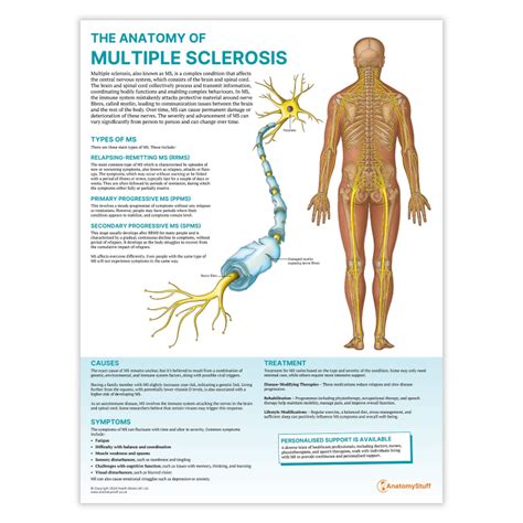 Multiple Sclerosis Chart