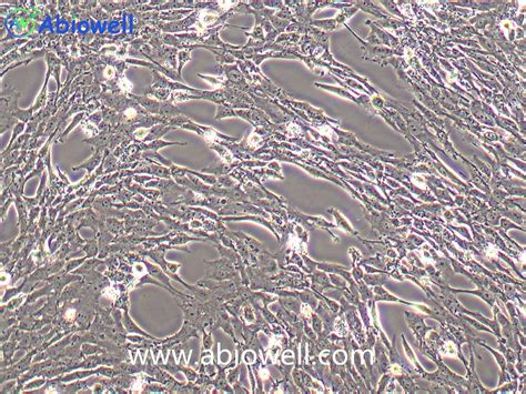 Rko 人结肠腺癌细胞（str鉴定）艾碧维生物官网