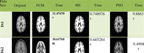 The Comparison Between Fcm Mean Shift Pso Segmentation Algorithms Download Table