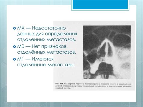 Рак Верхней Челюсти Online Presentation