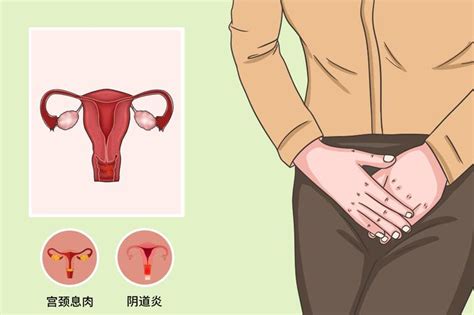 缩阴产品什么牌子效果好？调查清楚再选择！ 知乎