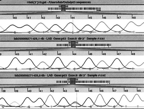 53 Sequencing Analysis Top Picture A Normal Sequence Of Exon 8