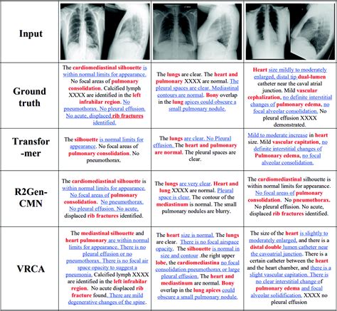 Visual Recalibration And Gating Enhancement Network For Radiology