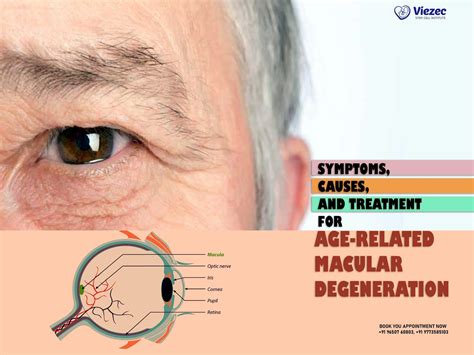Macular Atrophy Skin