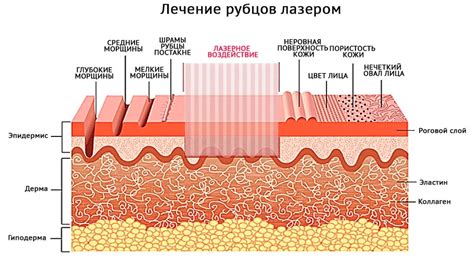 Как избавиться от рубцов и шрамов на лице?
