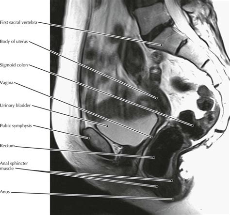 Rectum Anatomy Mri