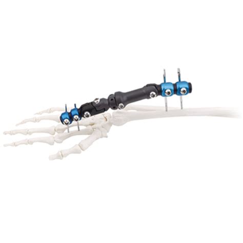 Wrist Joints External Fixator Orthopedic Drills Uk
