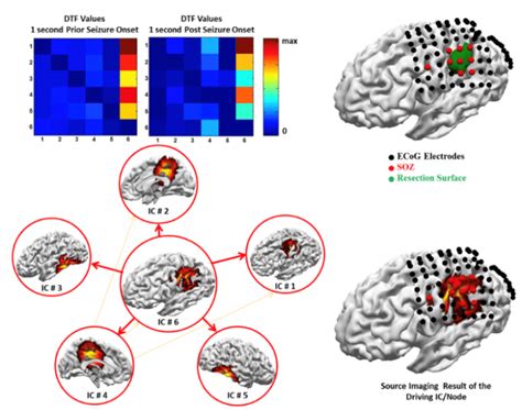 Identifying Epileptic Networks From Ictal Signals In A Patient Dynamic