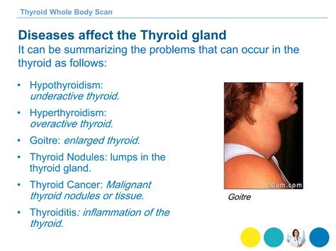 Thyroid Whole Body Scan Pdf