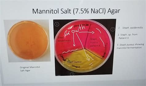 Solved Mannitol Salt 75 Nacl Agar 1 Staph Epidermitis