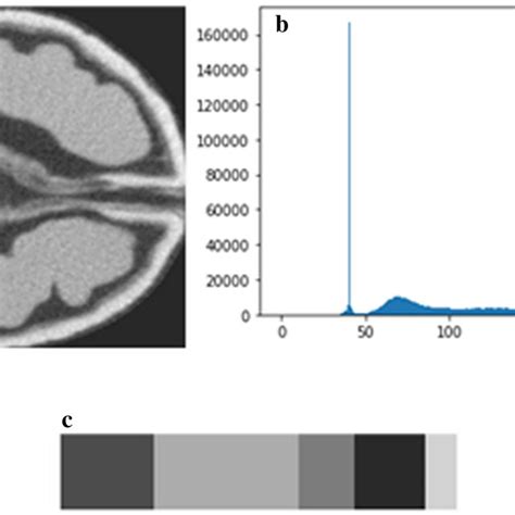 Greyscale Histogram Analysis A Example Of A 2d Slice B The