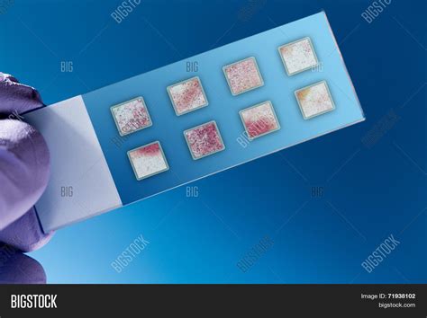 Dna Microarray Dna Chip Biochip Image And Photo Bigstock