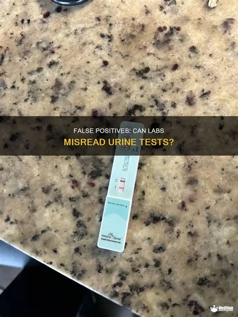False Positives Can Labs Misread Urine Tests Medshun
