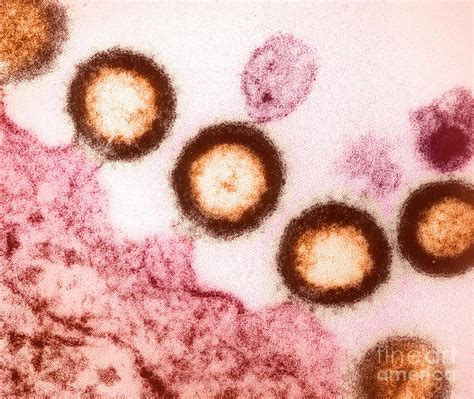 Hiv Particles Budding From Cell Photograph By Niaidnational Institutes