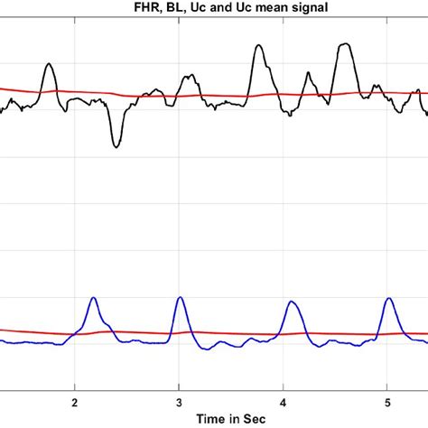 Fhr Signal And Uterine Contractions Full Size Doi Download Scientific Diagram