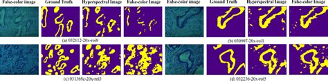 Visual Comparison Of Segmentation Results From Microscopic Download Scientific Diagram