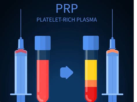 PRP Injection PRP Treatment Pune Dr Deshmukh S Pain Clinic Pune