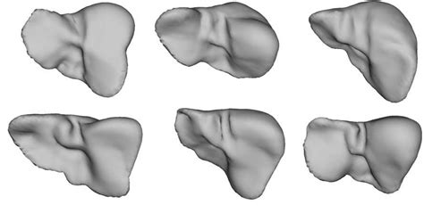 Figure 1 From Statistical Shape Models For 3d Medical Image Segmentation A Review Semantic
