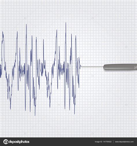 Polygraph Chart Markings Ponasa